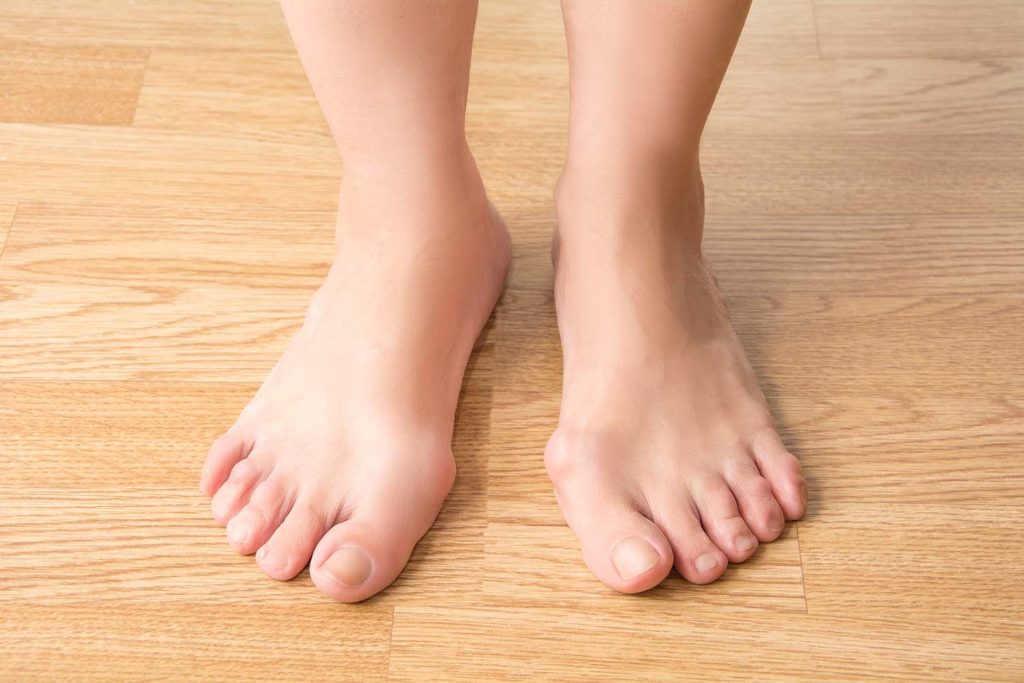 Plantar Warts - Verruca Pedis | Northern Rivers Podiatry