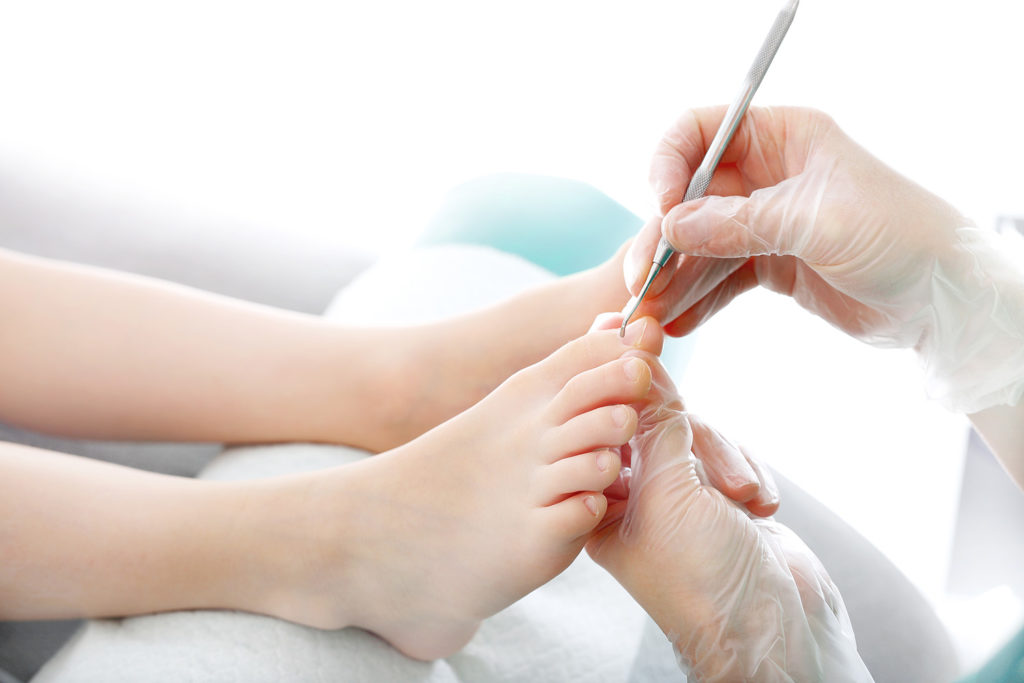 Plantar Warts - Verruca Pedis | Northern Rivers Podiatry